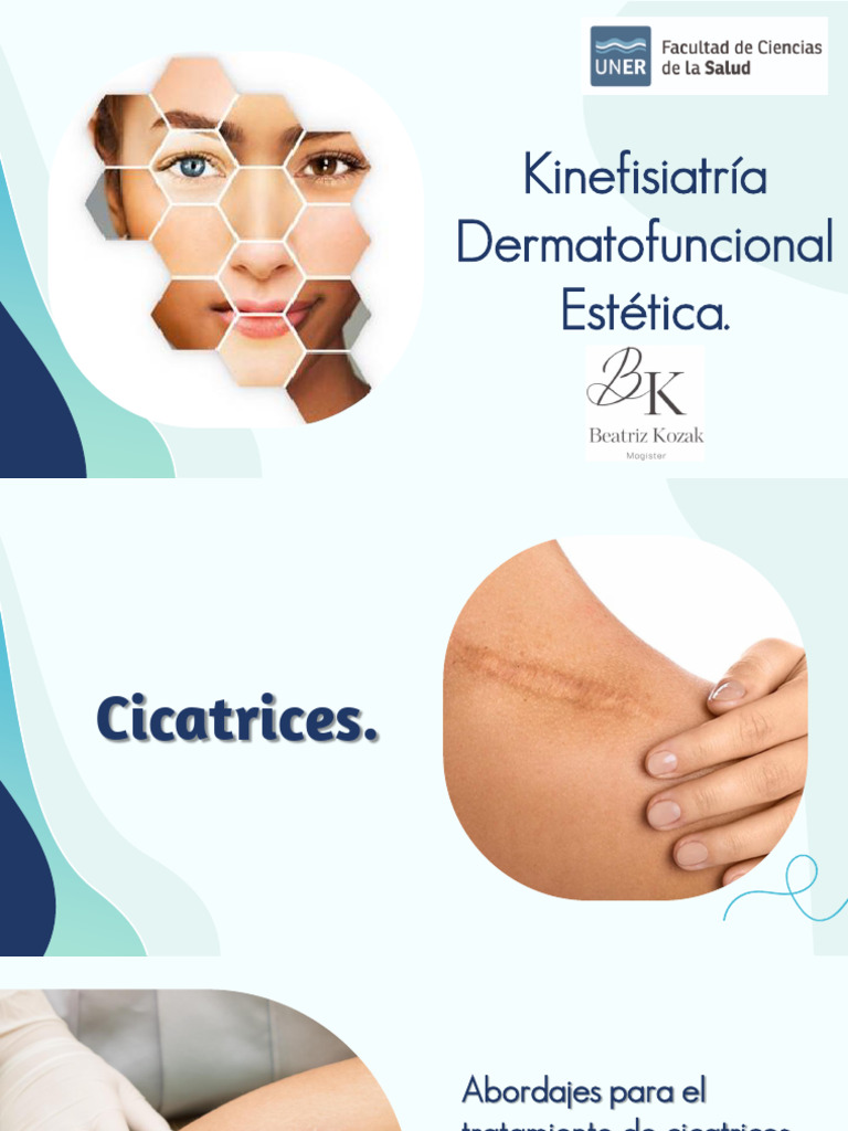 Cicatrices y Estrías. | PDF | Cicatrización de la herida | Cicatriz