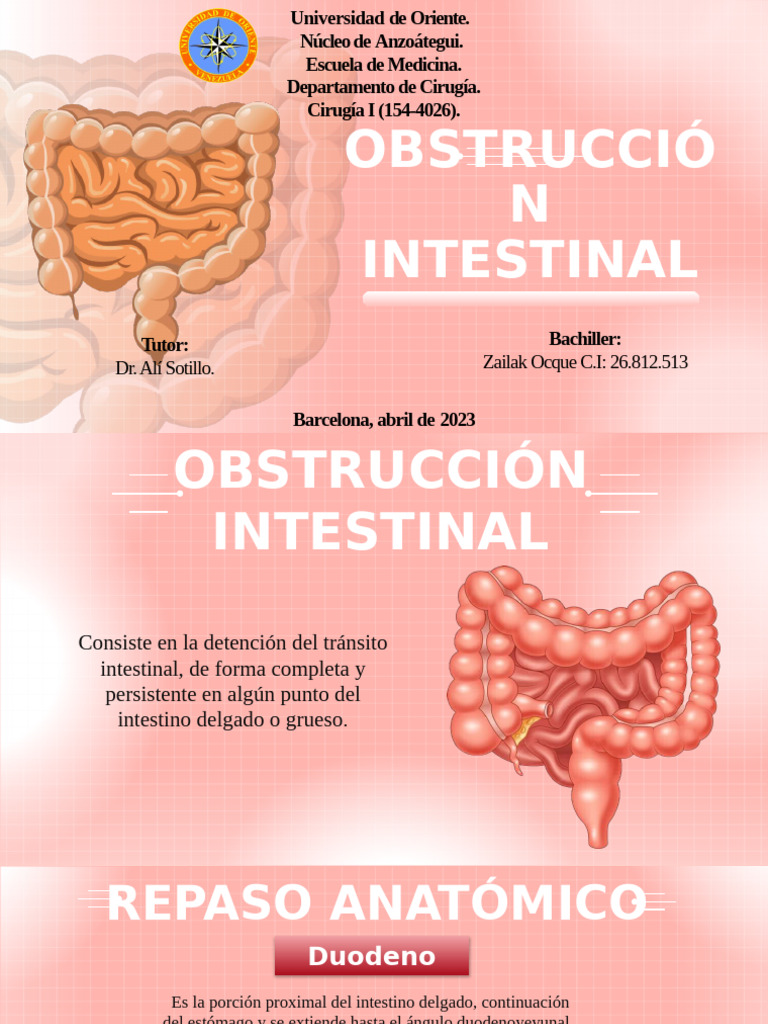 Obstrucción Intestinal: Anatomía y Diagnóstico | PDF | Tracto ...