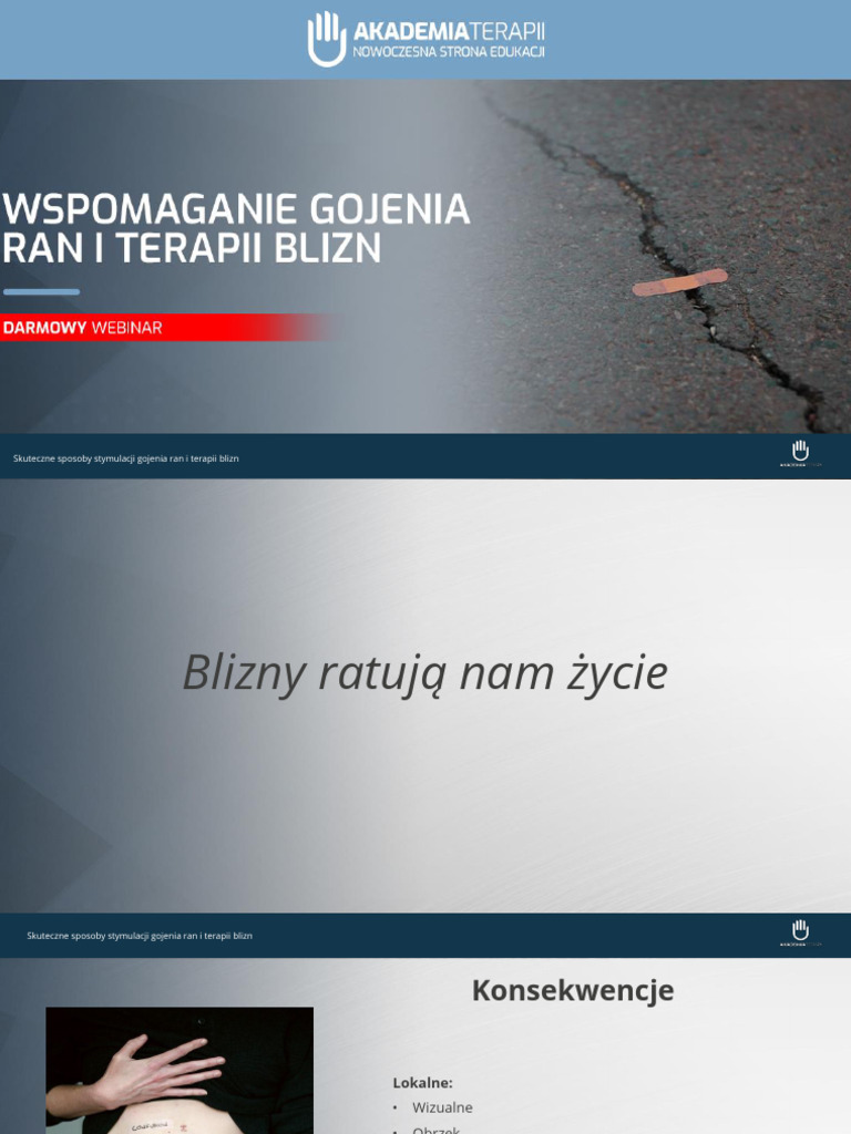 Stymulacja gojenia ran i terapii blizn | PDF