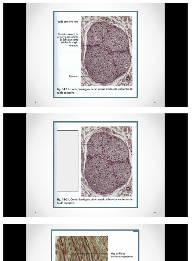 Neuro Final Imagenes | PDF