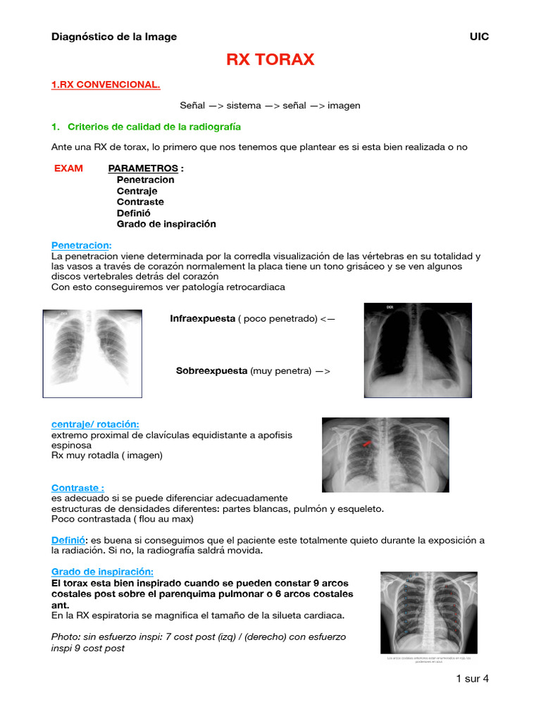 13 - RX Torax | PDF | Tórax | Pulmón