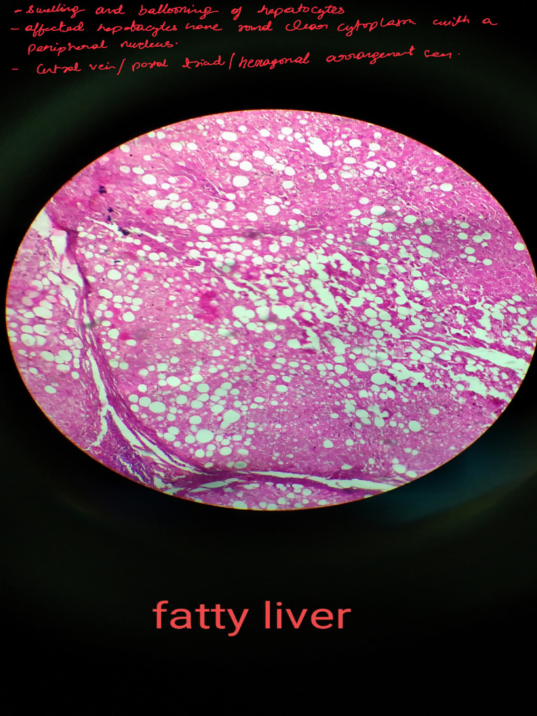 Histopath Slides Exclusive | PDF
