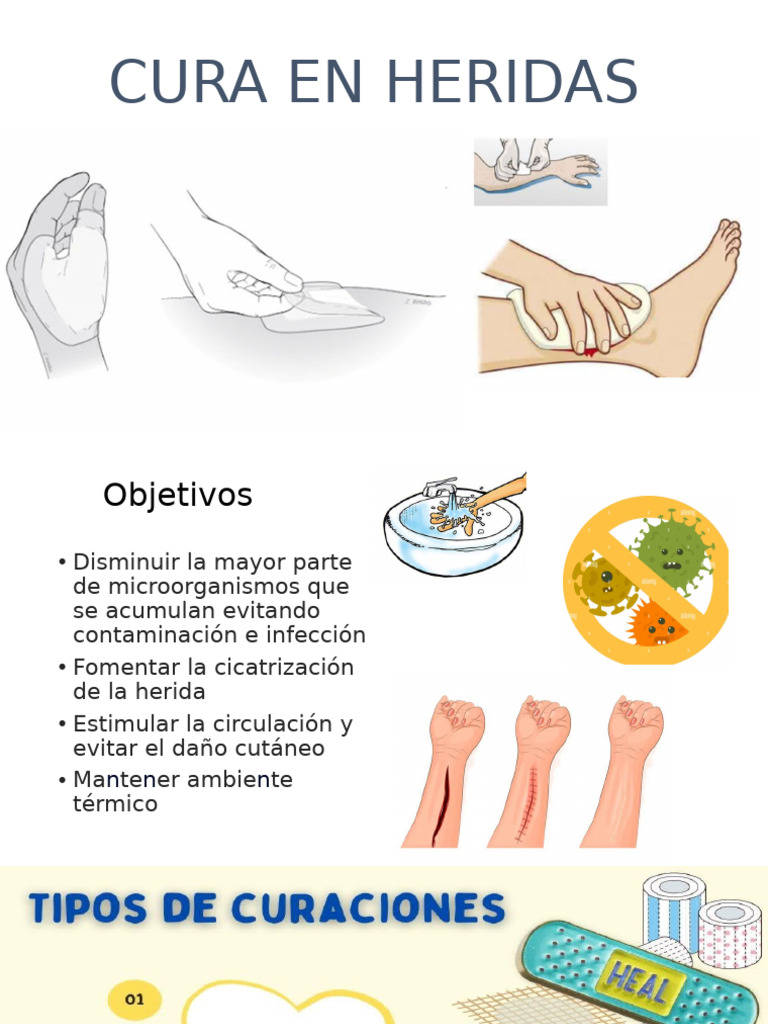 Tipos de Curaciones en Heridas | PDF