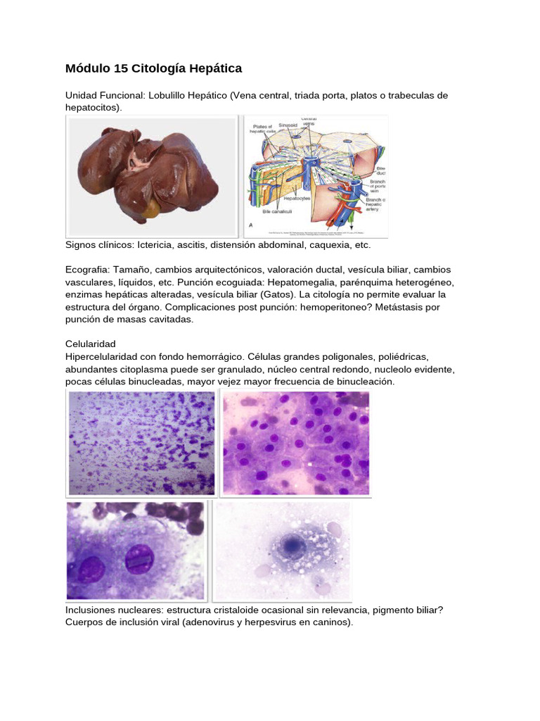 M+ Dulo 15 Citologia Hep+ítica | PDF | Hepatocito | Inflamación