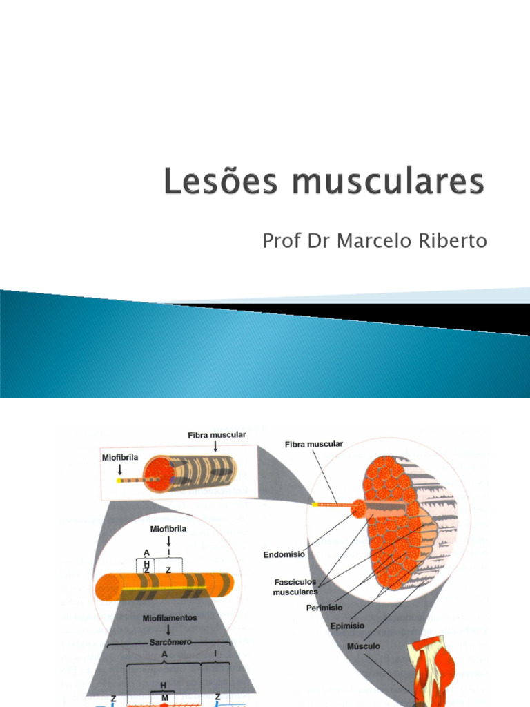 Lesões Musculares e Tratamento | PDF | Músculo | Inflamação
