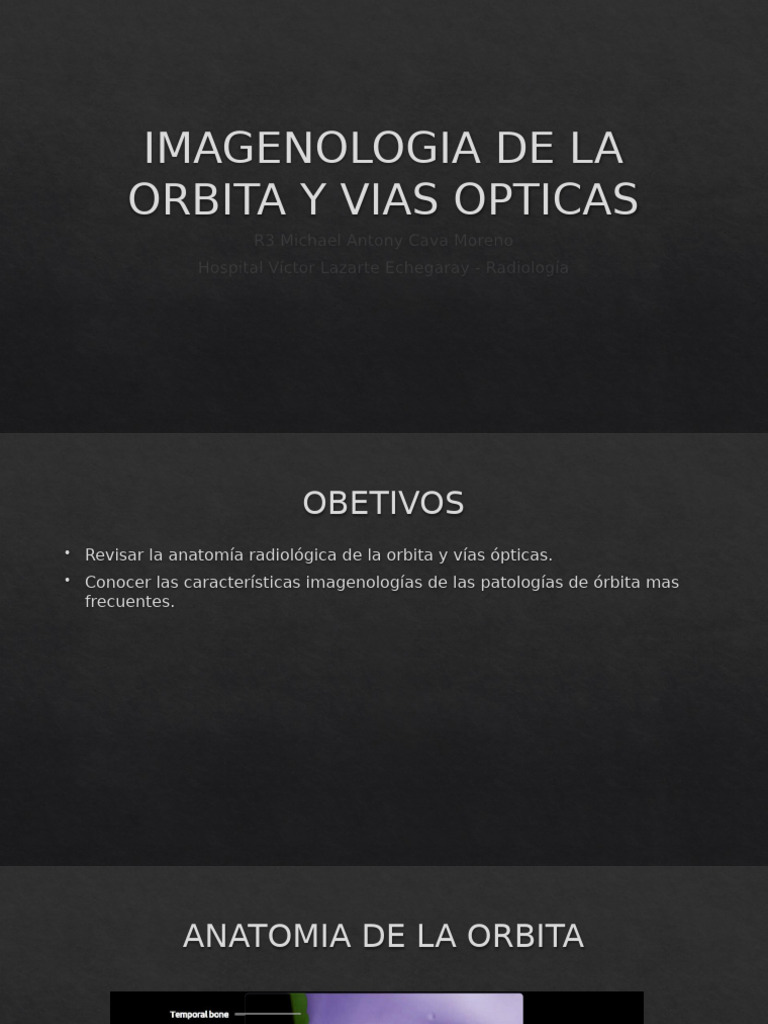 Radiologia de La Orbita Vias Opticas | PDF | Neoplasias | Cáncer