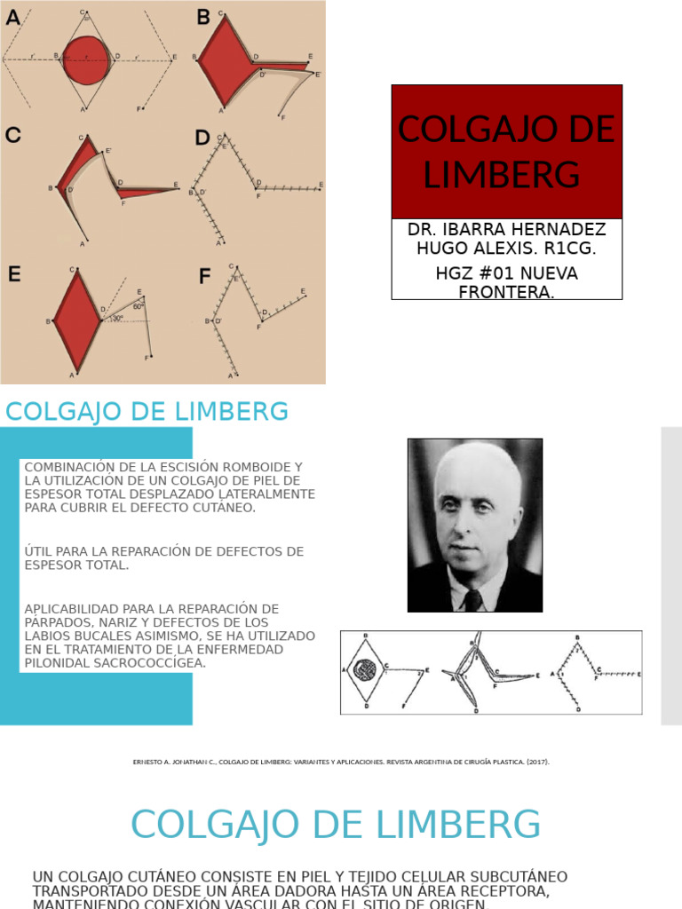 Colgajo de Limberg en Cirugía Reconstructiva | PDF | Especialidades ...
