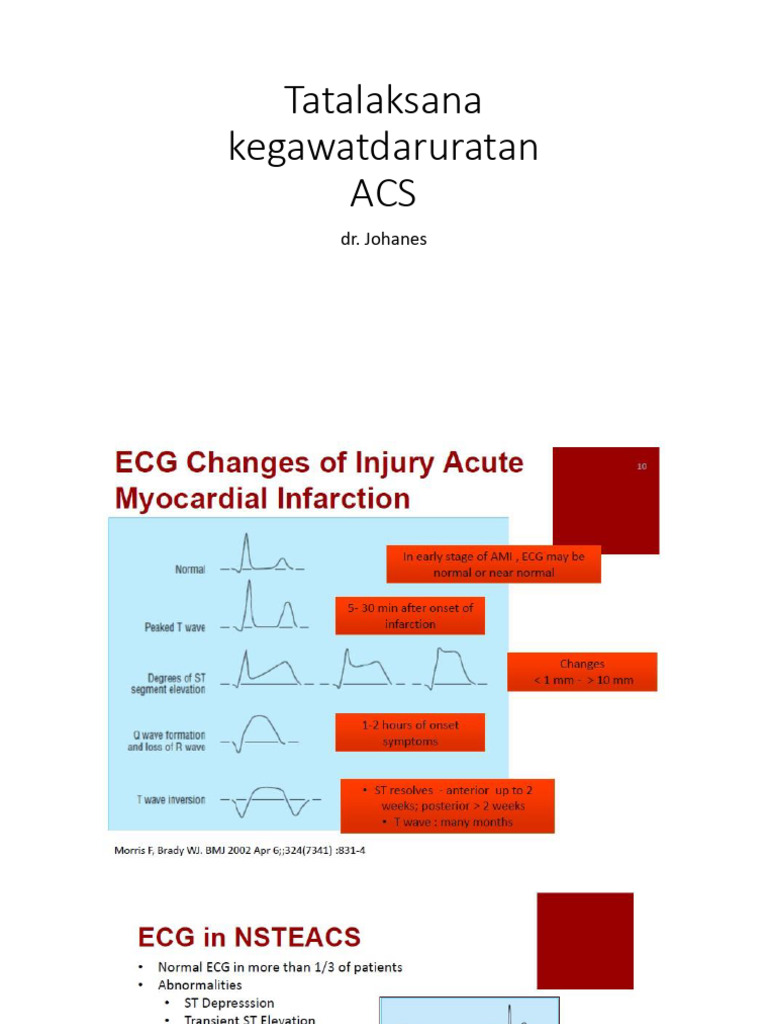 Tatalaksana ACS | PDF | Myocardial Infarction | Heart