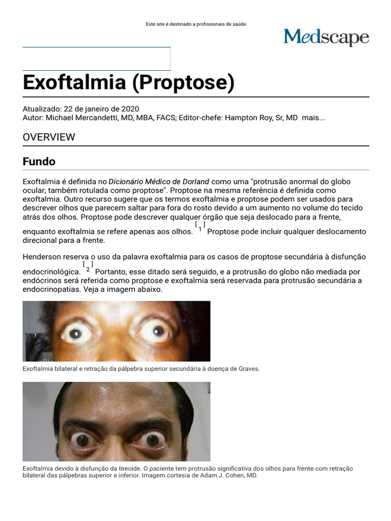 Exoftalmia: Causas e Tratamentos | PDF | Olho | Sistema visual
