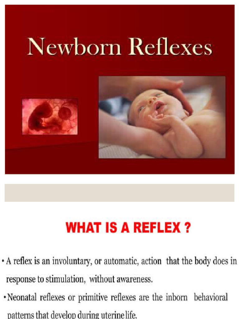 Newborn Reflexes | PDF