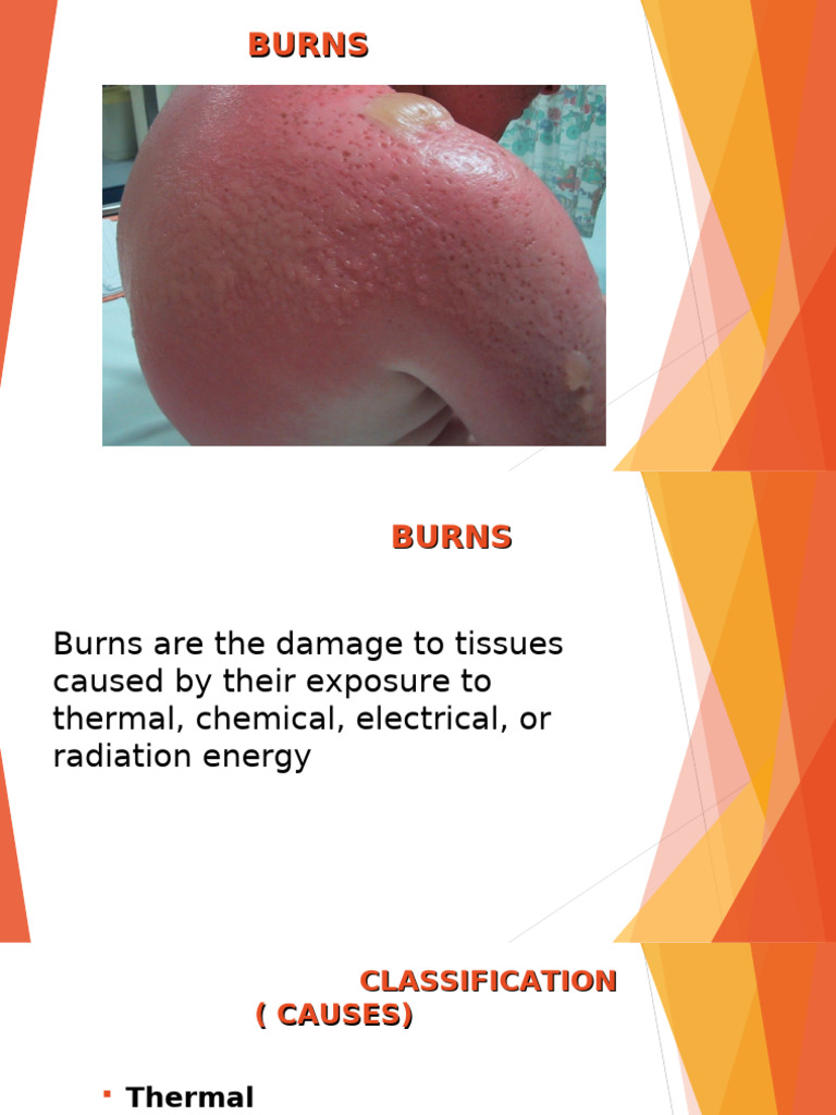 Burns and Frost Bite | PDF | Burn | Clinical Medicine
