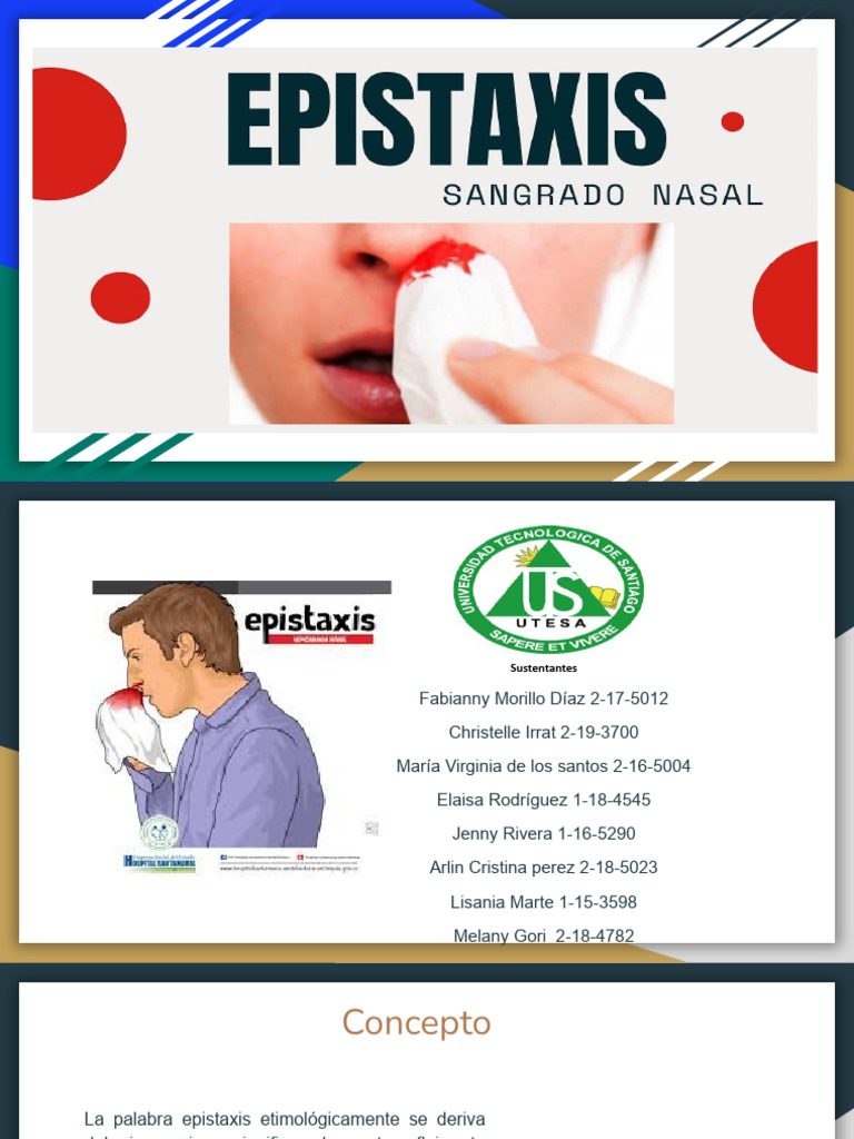 Epistaxis | PDF | Medicina CLINICA | Especialidades Medicas