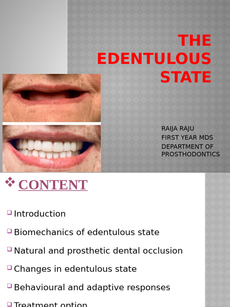 The Edentulous State | PDF | Dentures | Taste