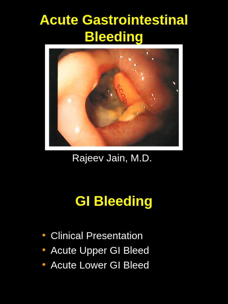 RJ GI Bleed | PDF | Medical Specialties | Diseases And Disorders