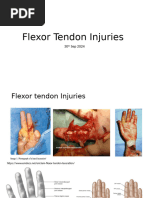 Mini Tightrope CMC Fixation | PDF | Thumb | Musculoskeletal System