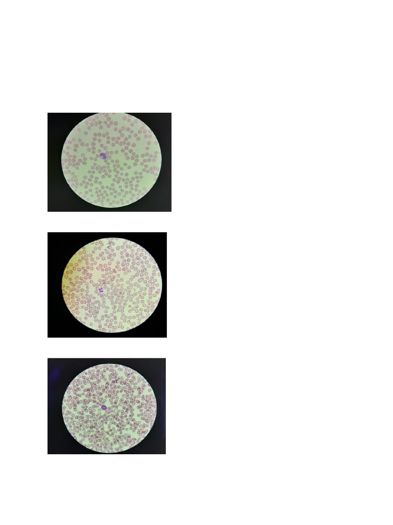 Identificación de Glóbulos Blancos | PDF | Leucocito | Especialidades Medicas