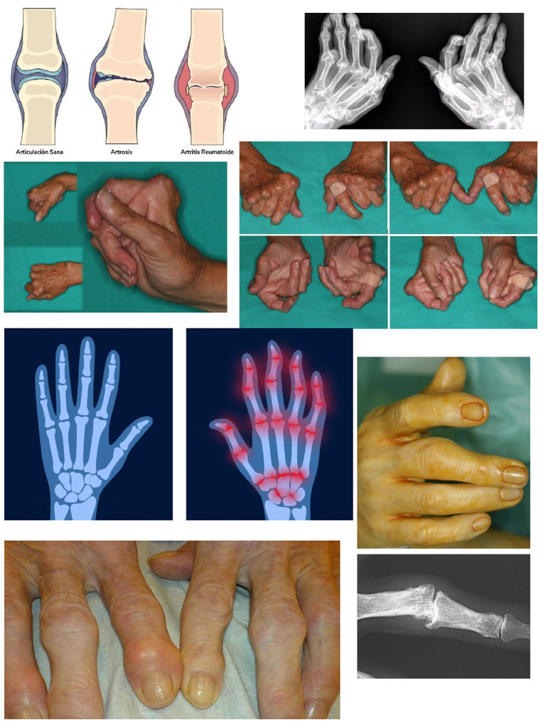 Documento (2) W | PDF