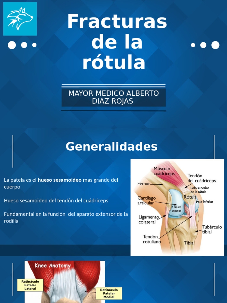 Fracturas de Rótula: Diagnóstico y Tratamiento | PDF | Rodilla ...
