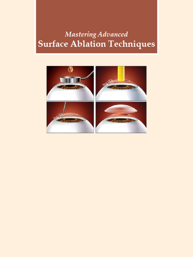 Mastering Advanced Surface Ablation Techniques | PDF | Ophthalmology ...