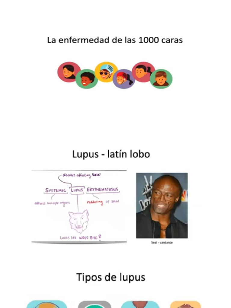Lupus | PDF