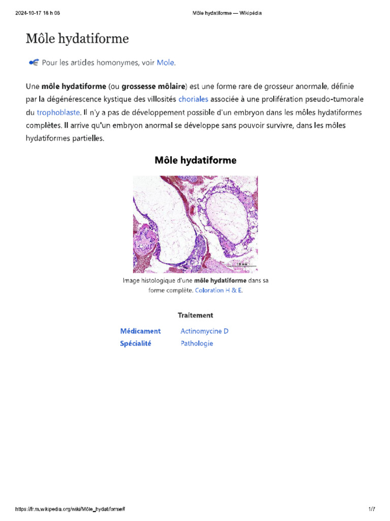 Môle Hydatiforme - Wikipédia | PDF
