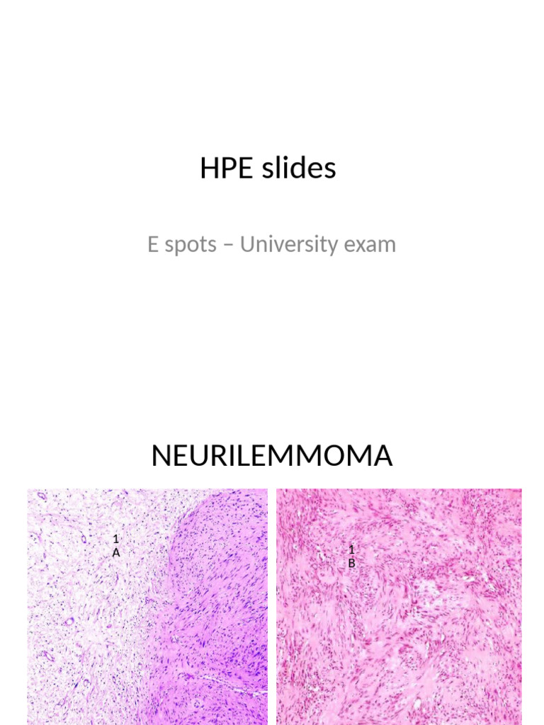 HPE Slides UNI - Exam E Spots | PDF | Wellness