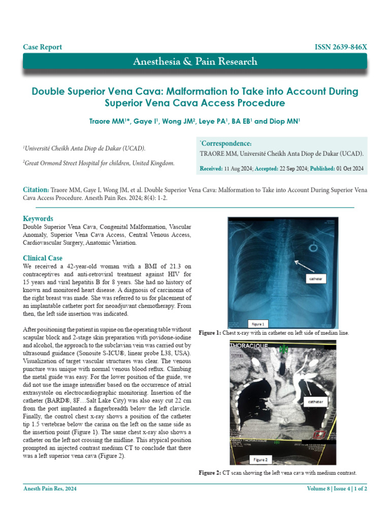 Double Superior Vena Cava Malformation To Take Into Account During ...