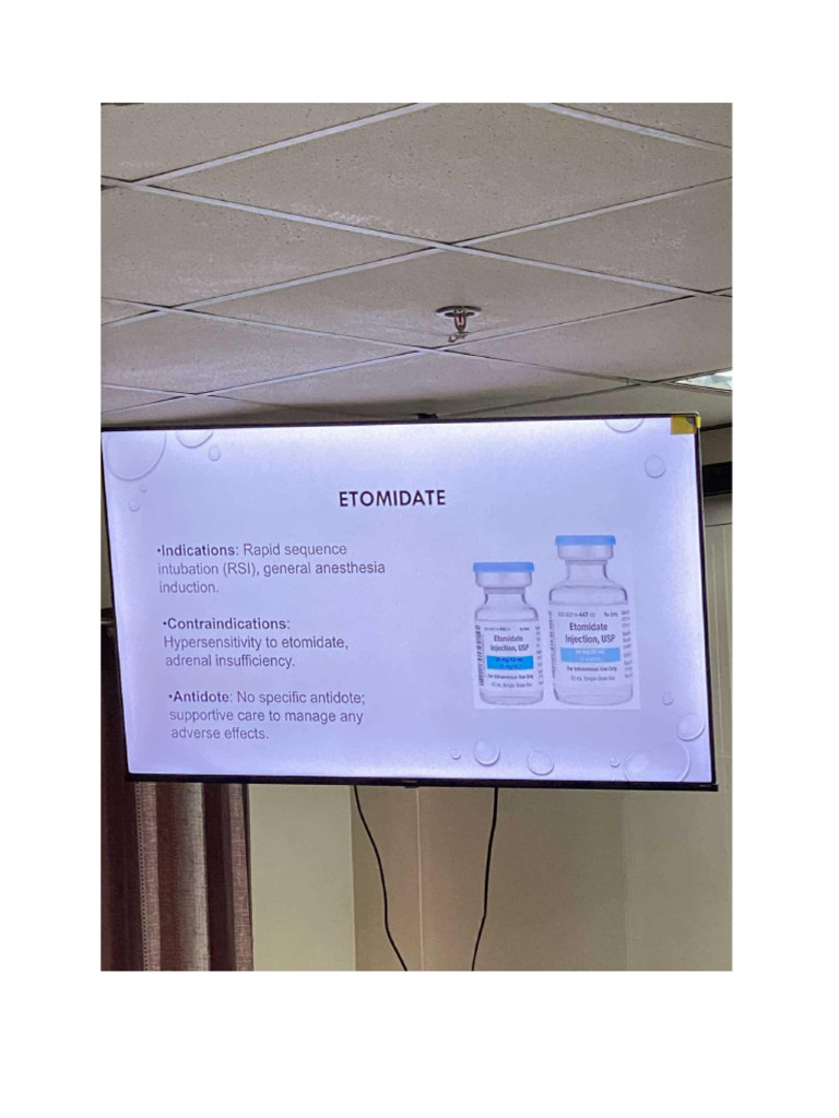 ETOMIDATE | PDF