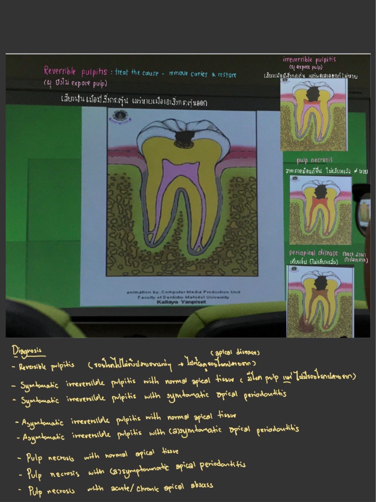 Pulpal Disease | PDF