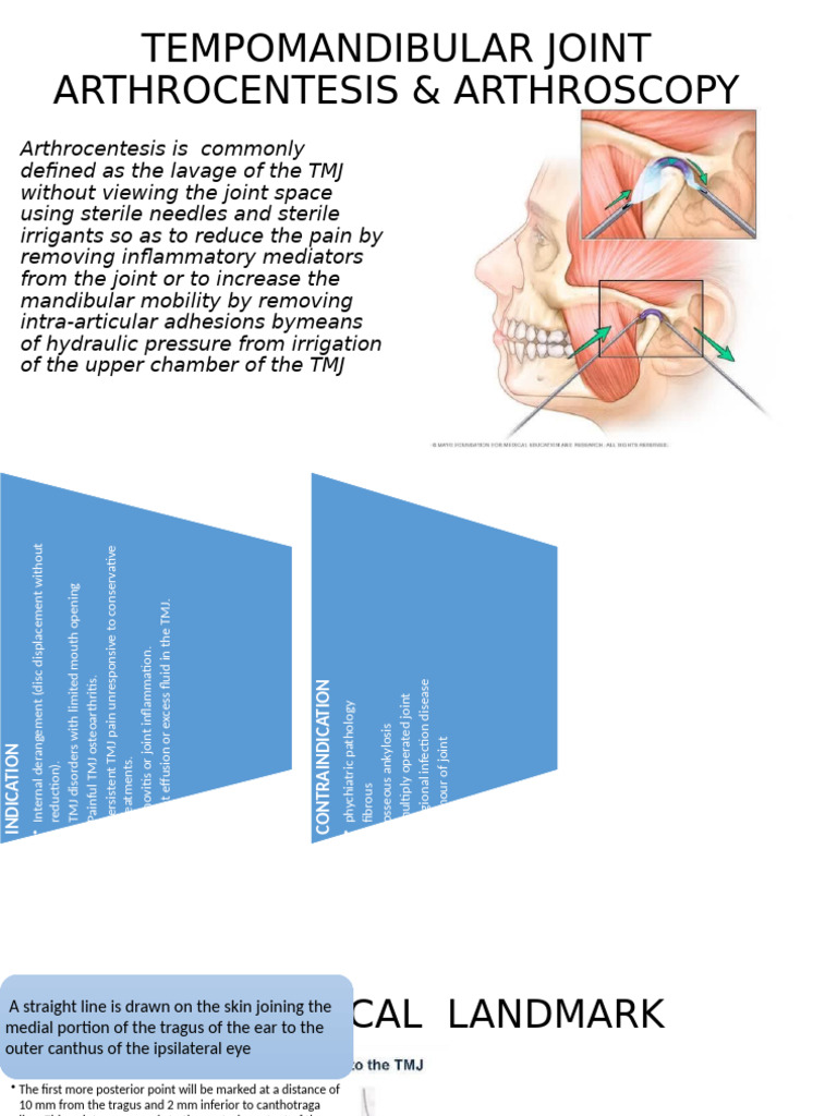 Tempomandibular Joint Arthrocentesis | PDF | Clinical Medicine ...