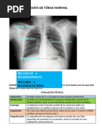 Signos Radiologicos Del Torax | PDF | Tórax | Pulmón