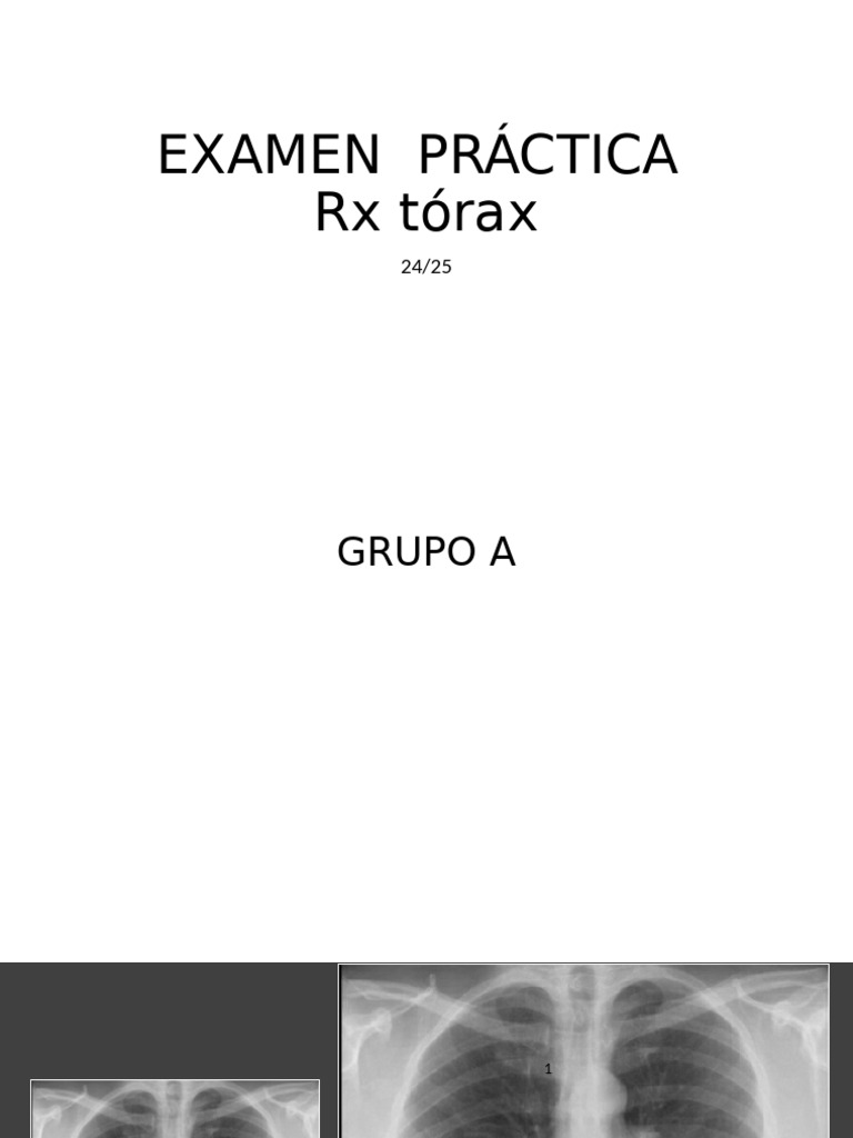 24-25 Con Respuestas Examen Práctica RX TX | PDF | Neumonía | Causas de la muerte