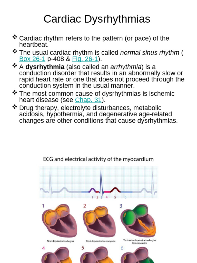 Cardiac Dysrhythmias | PDF | Artificial Cardiac Pacemaker | Heart
