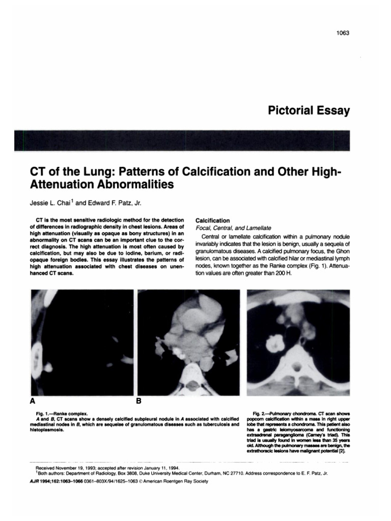 Chai Patz 2013 CT of The Lung Patterns of Calcification and Other High ...