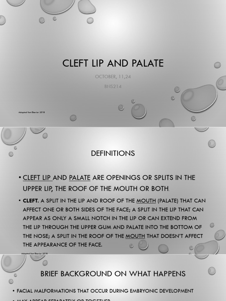 Cleft Lip and Palate | PDF | Breastfeeding | Surgery