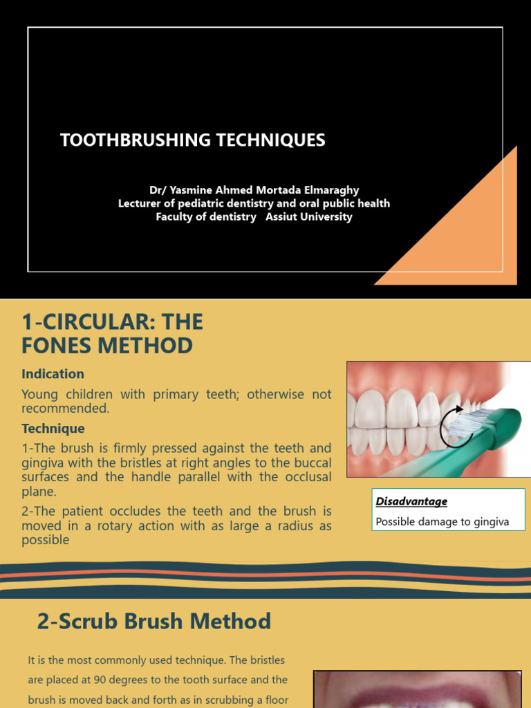 Tooth Brushing Technique PDF | PDF | Dentistry Branches | Mouth