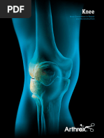 FiberStitch™ Meniscal Repair Technique | PDF | Surgical Suture ...