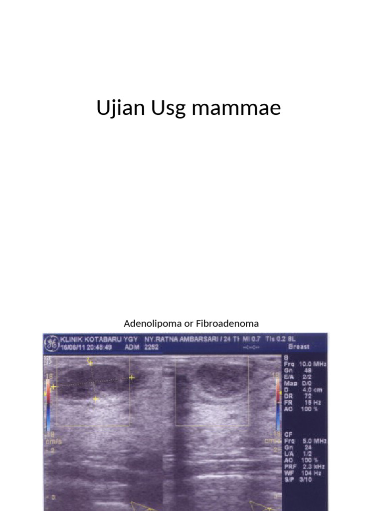 Ujian Usg Mammae | PDF
