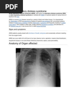Mechanical Ventilation - Lessons From The ARDSNet Trial | PDF ...