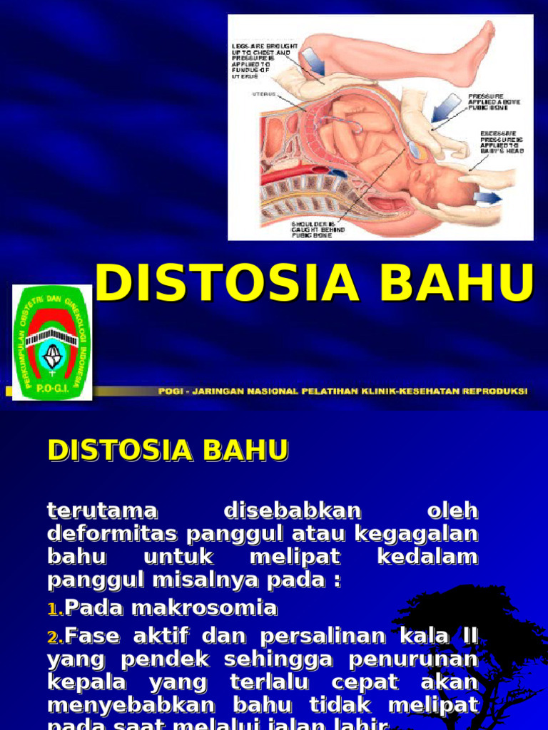 Distosia Bahu | PDF