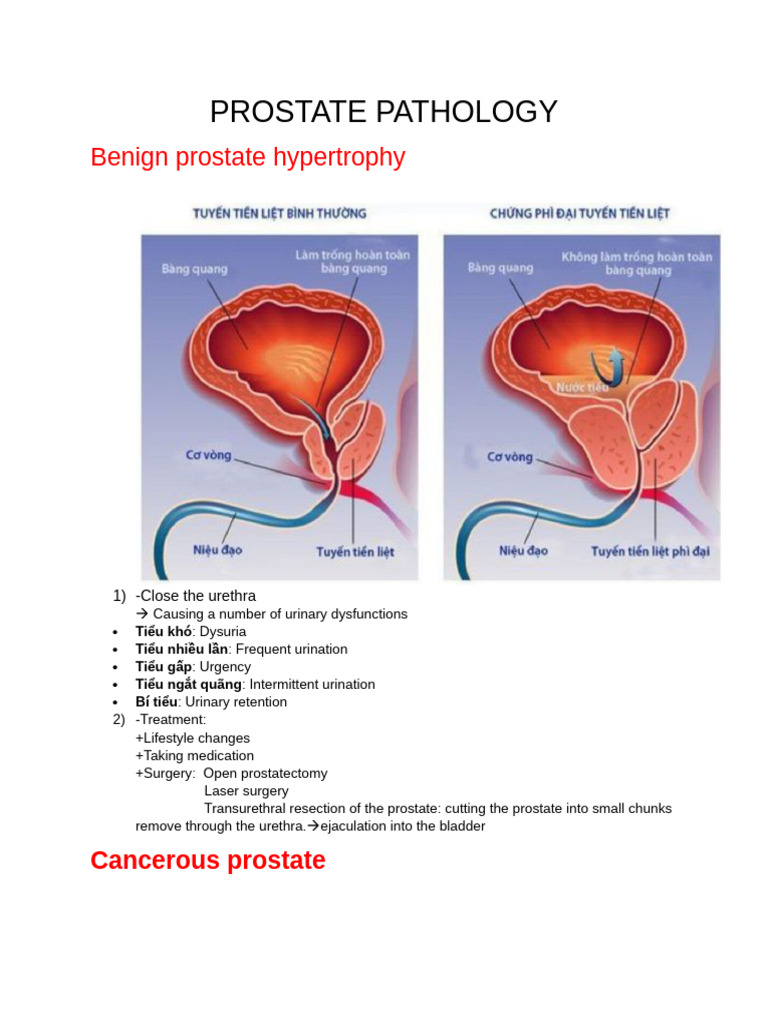Prostate Pathology | PDF