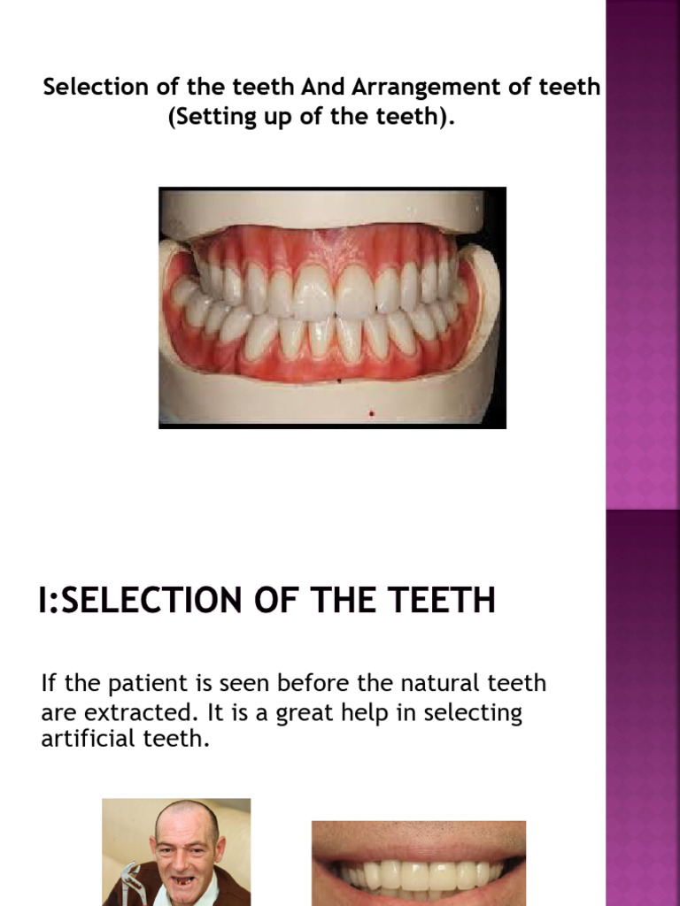 Teeth Selection and Arrangement Guide | PDF | Dental Anatomy | Dentures