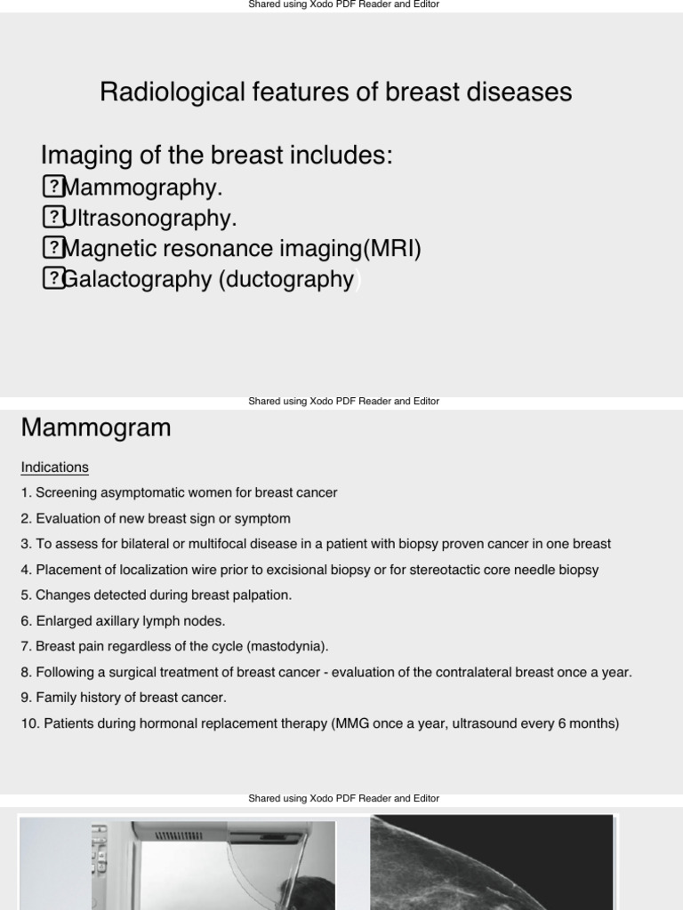 Breast Practica For Studentsl | PDF | Breast Cancer | Mammography