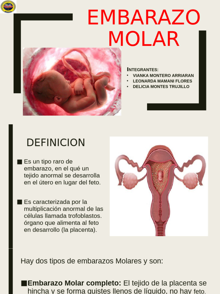 Embarazo Molar: Tipos y Tratamiento | PDF | El embarazo | Placenta