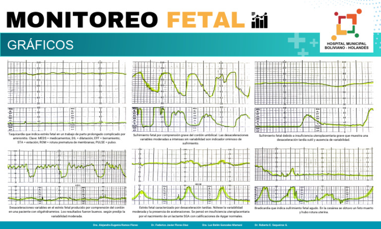 Monitoreo Fetal - Graficos | PDF