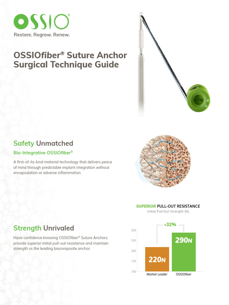 OSSIOfiber® Suture Anchor Technique Guide | PDF | Surgical Suture | Knee