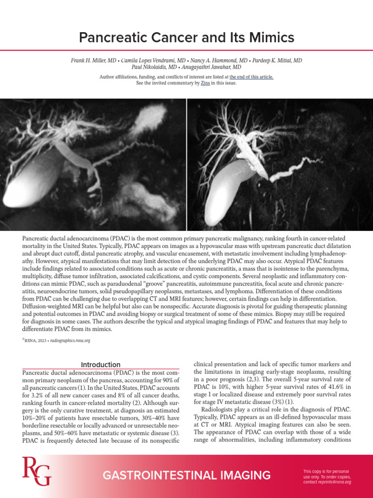 Miller Et Al 2023 Pancreatic Cancer and Its Mimics | PDF | Pancreatic ...