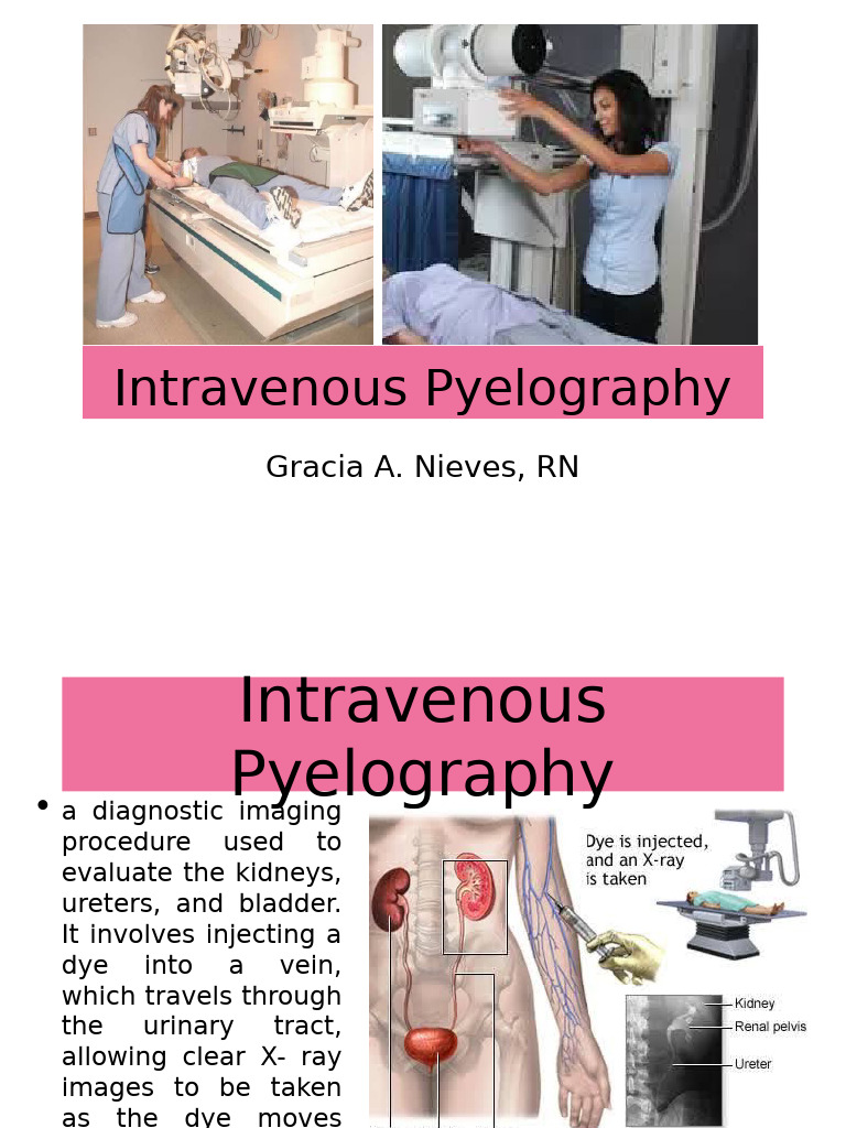 Intravenous Pyelography | PDF | Diseases And Disorders | Urinary System