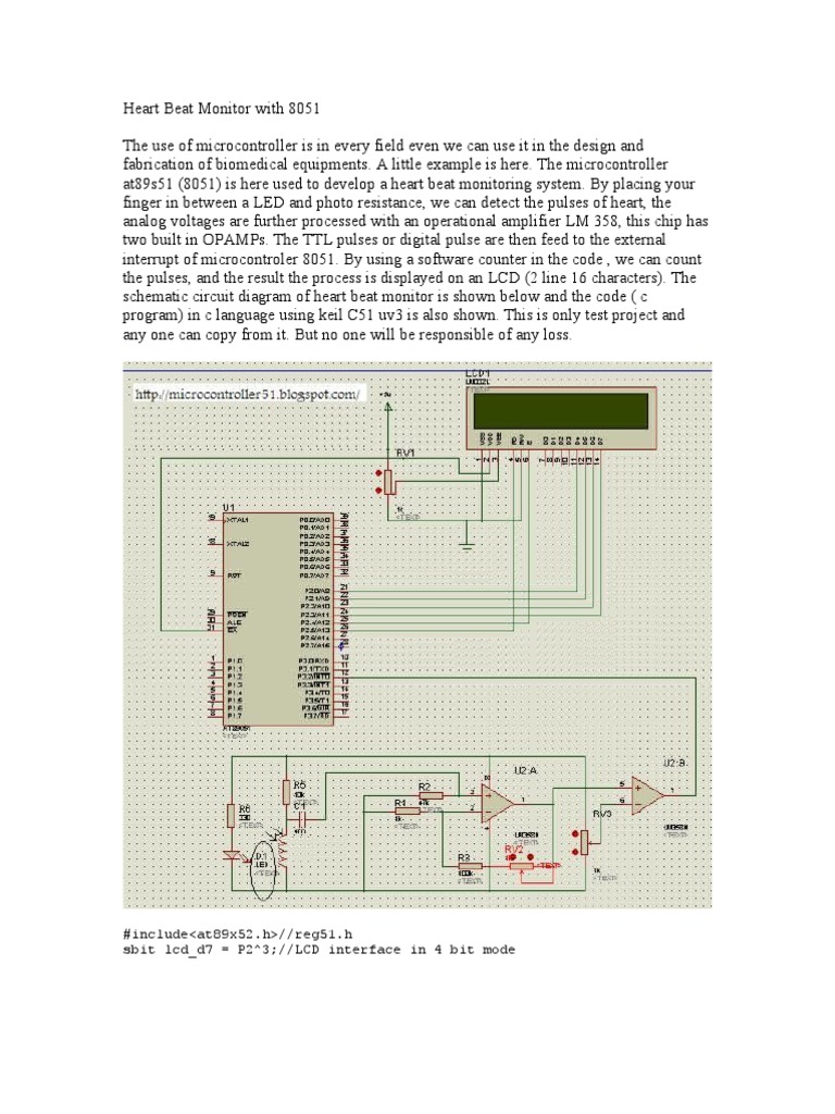Heart Beat Monitor With 8051 | PDF | Technology & Engineering