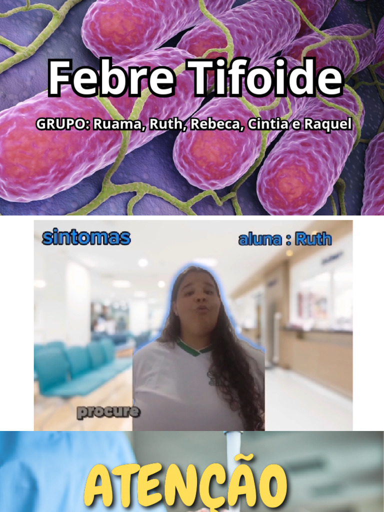 Febre Tifoide - 20240929 - 234114 - 0000 | PDF